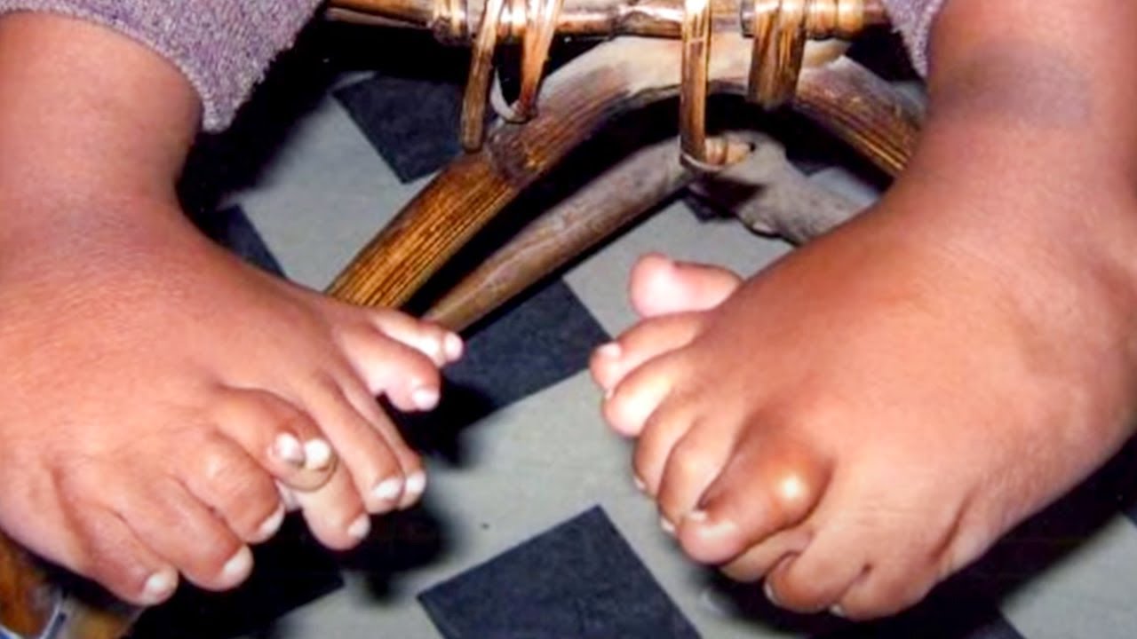 10 PEOPLE WITH EXTRA BODY PARTS YouTube 10-people-with-extra-body-parts-youtube