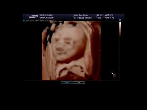 5D ultrasound 24 weeks and 6 days - YouTube