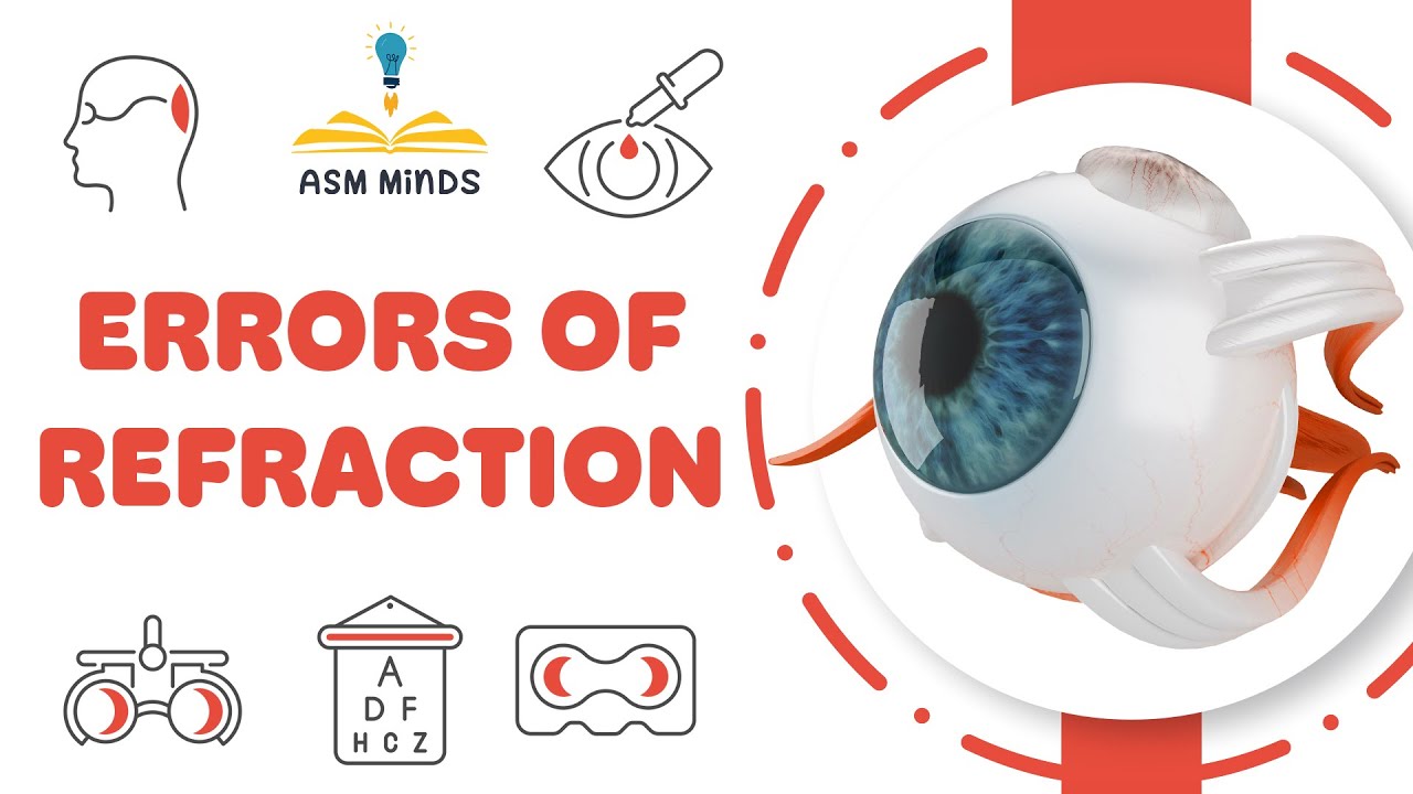 Errors of Refraction (Ophthalmology) - YouTube