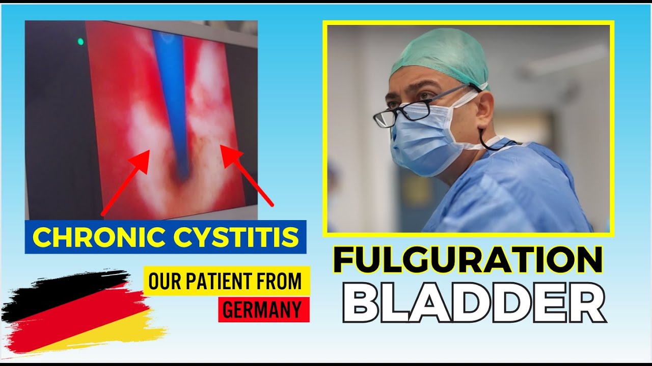 Chronic Cystitis Solved – German Patient’s Journey | Watch the Bladder ...