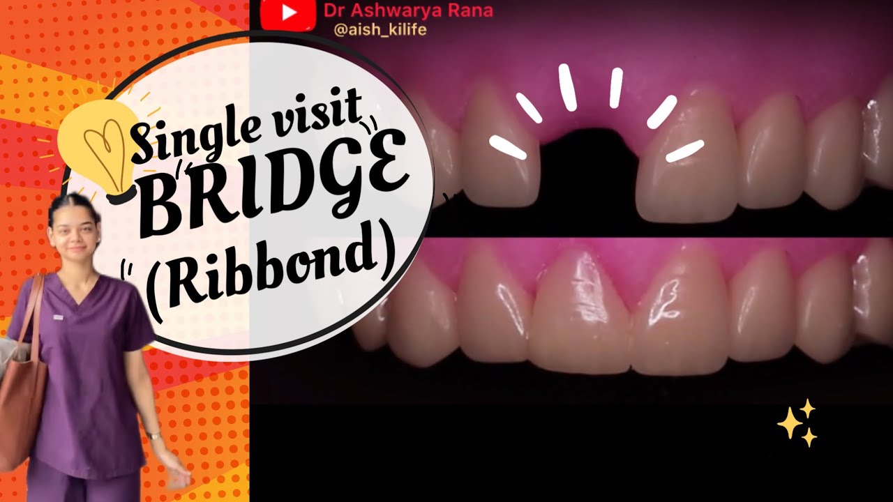 SINGLE - VISIT BRIDGE (RIBBOND) - YouTube