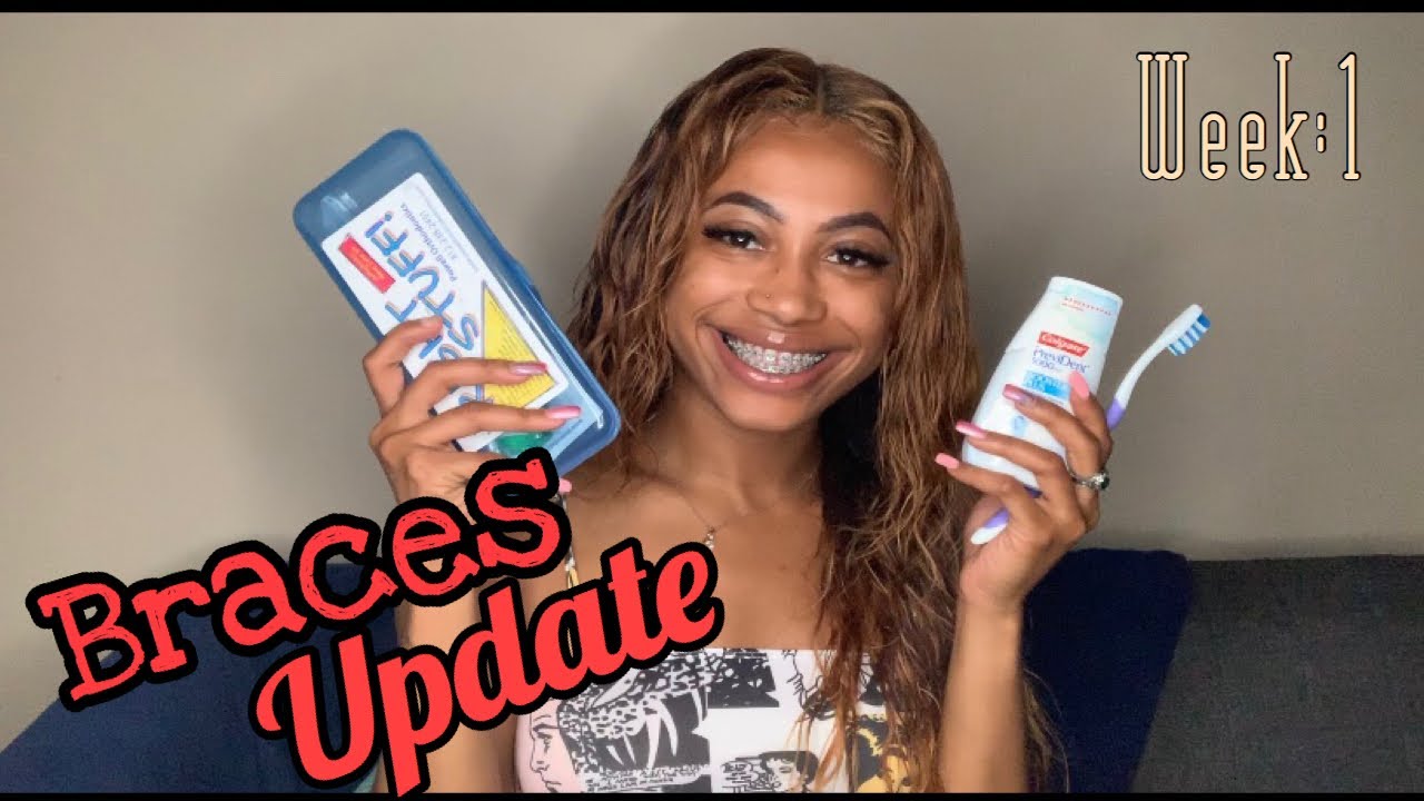 Braces Update. Week 1 - YouTube