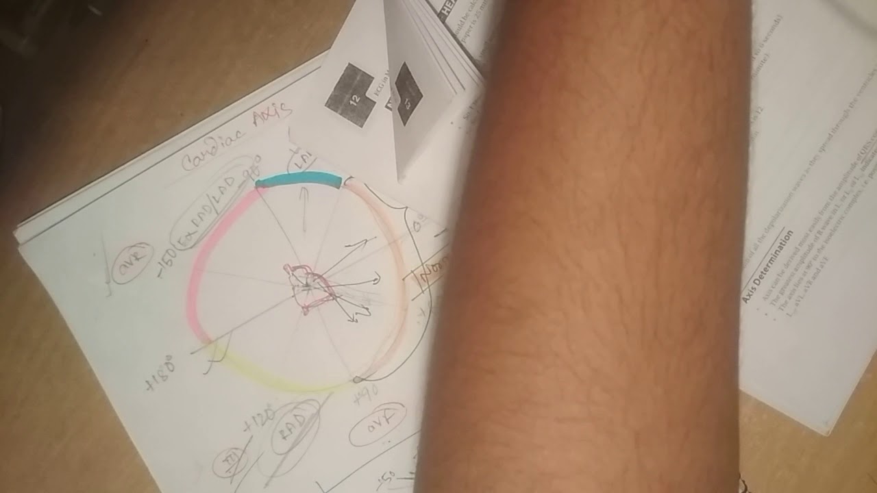 ECG cardiac axis explained - YouTube