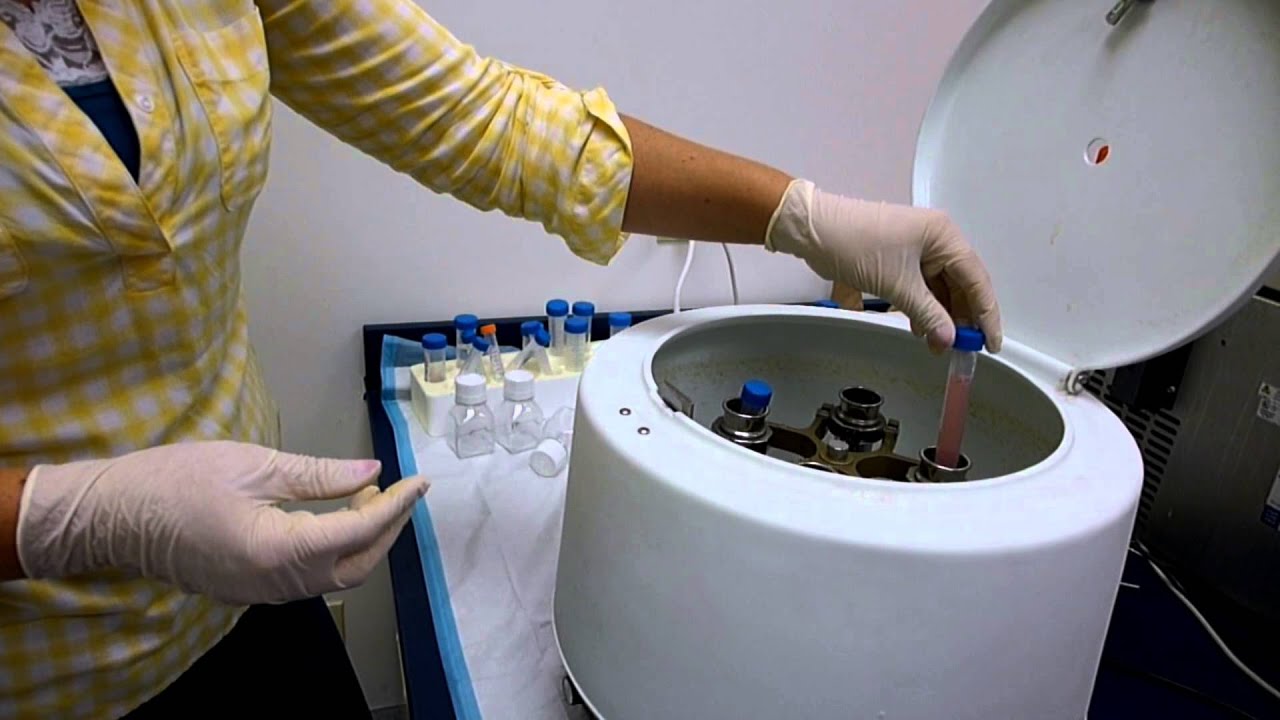 Isolating Exosomes from media using ExoQuick-TC - YouTube