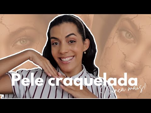 Pele Craquelada - Como resolver | Manu Oliver - YouTube