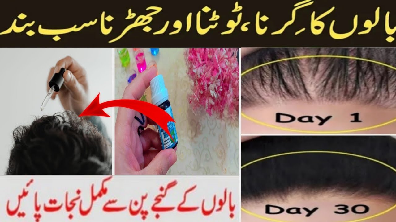 Powerful Hair Growth Oil Hair Fall Solution The Natural Way - YouTube