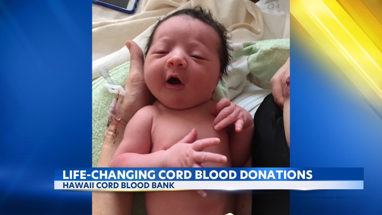 Hawaii Cord Blood Bank changes lives with umbilical cords' life-saving ...