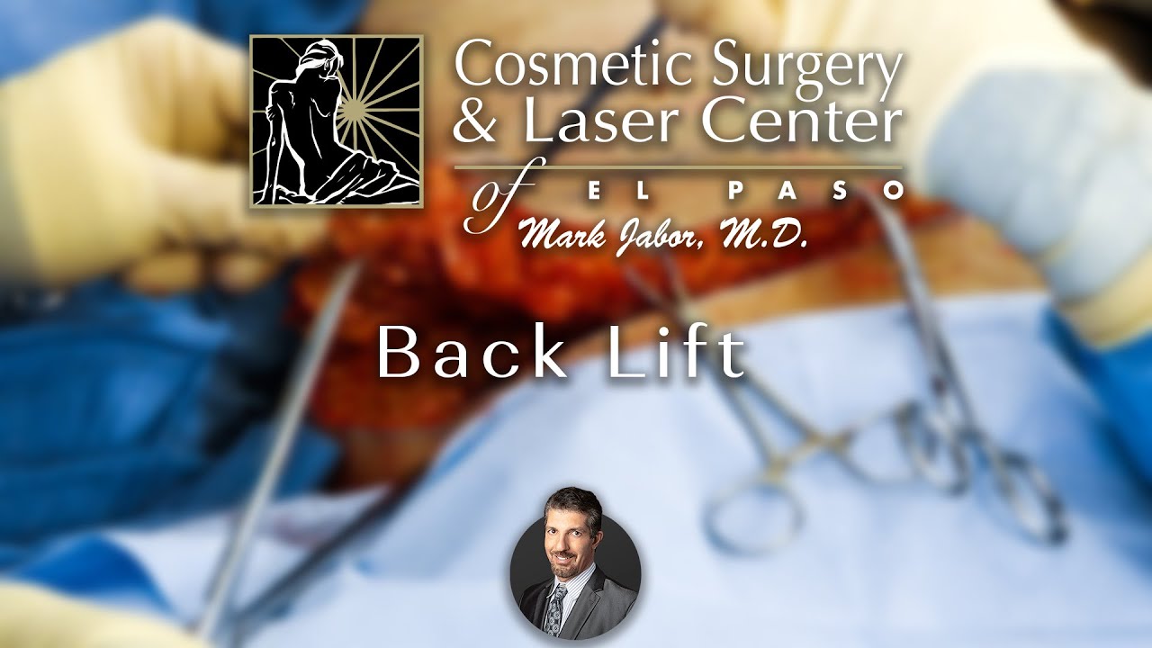 Back Lift | Dr. Jabor | Cosmetic Surgery and Laser Center of El Paso ...