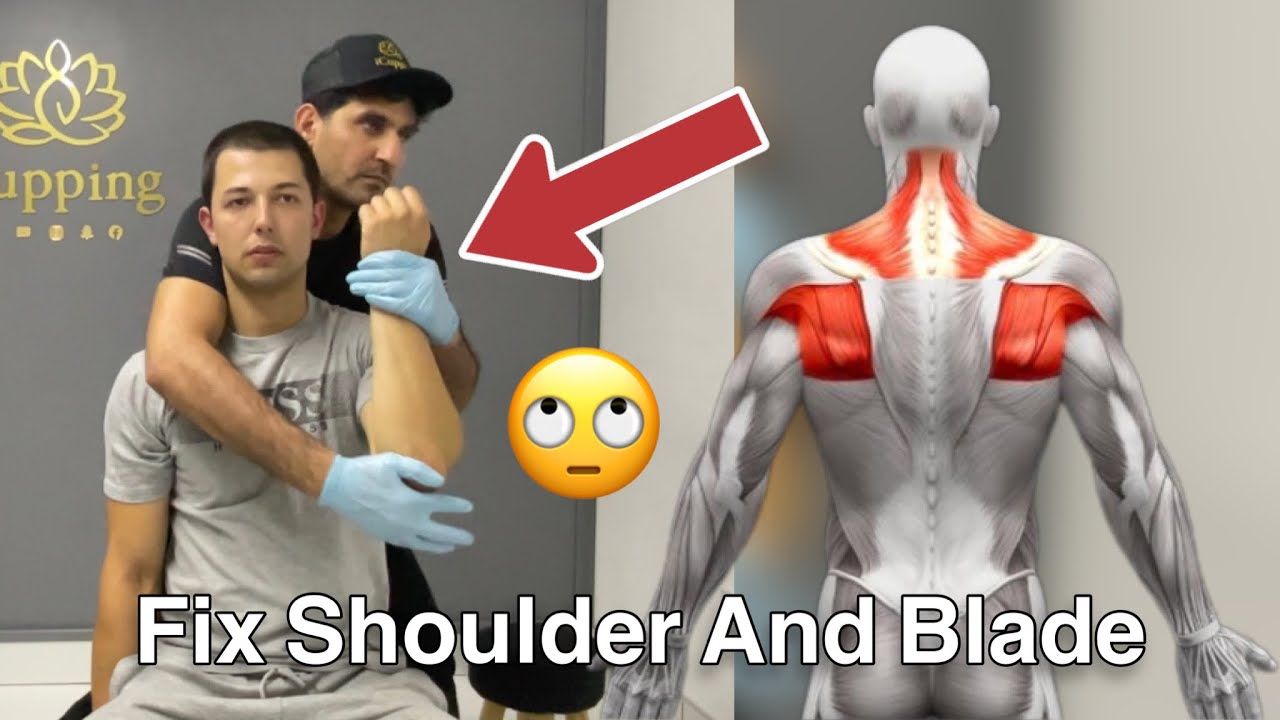 Full Body alignment by iCupping #backpain #neckpain #crackingbones ...