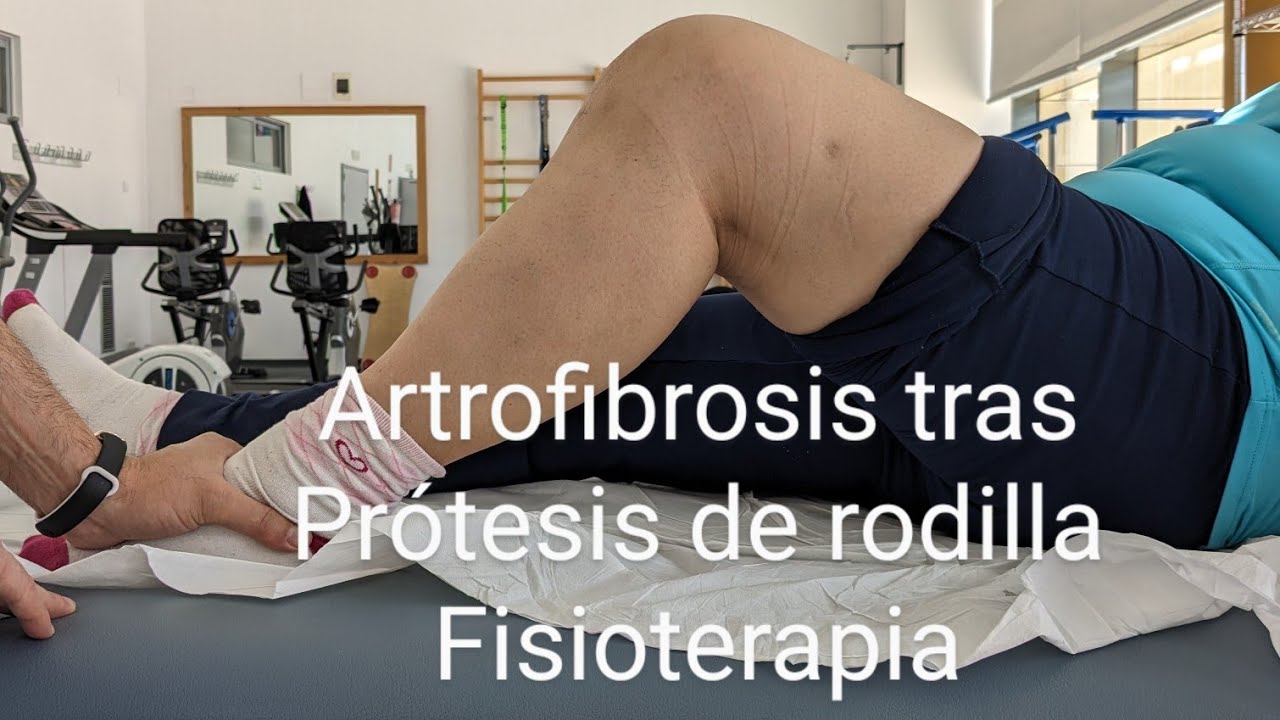 Artrofibrosis tras prótesis de rodilla: fisioterapia - YouTube