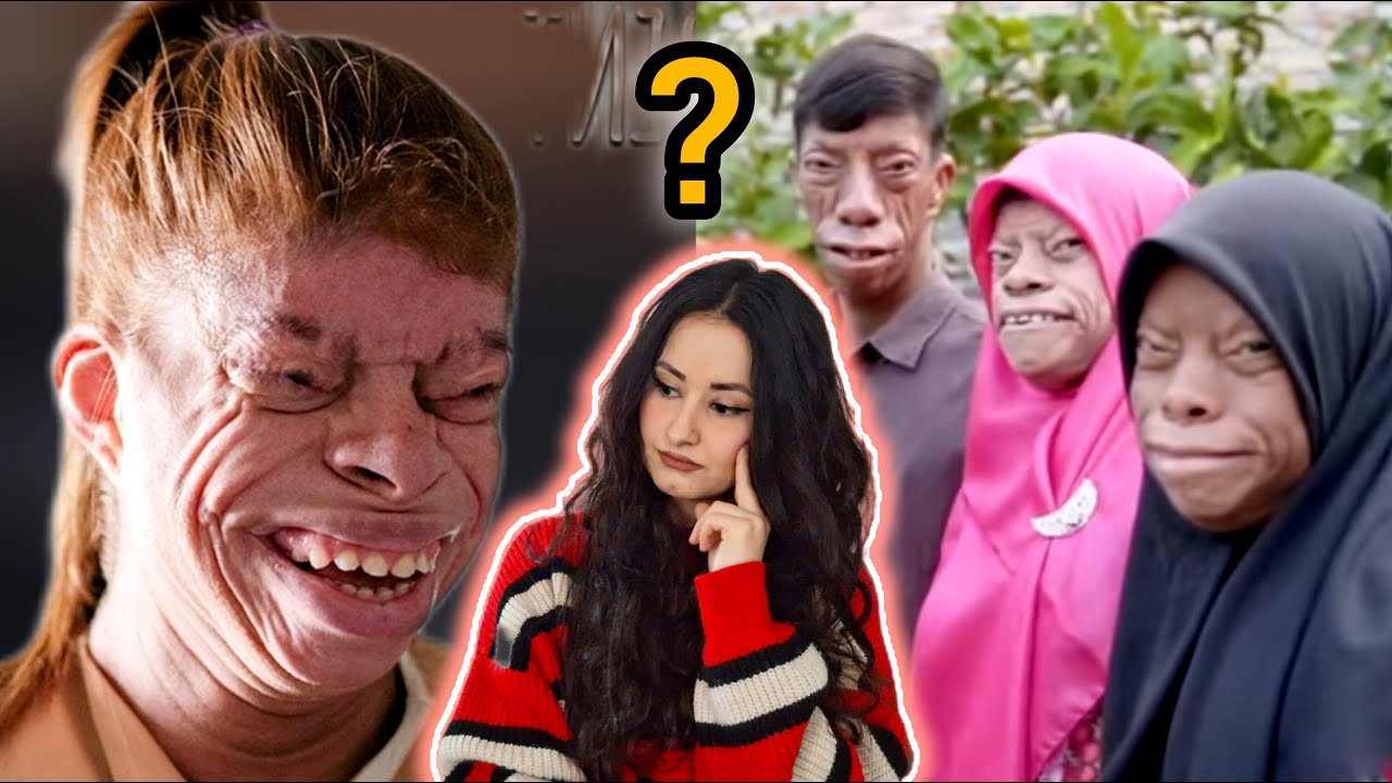 Yüzleri degisen insanlar - Barber Say Sendrom - YouTube