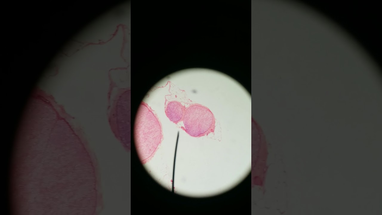 Cross-section peripheral nerve connective tissue histology - YouTube