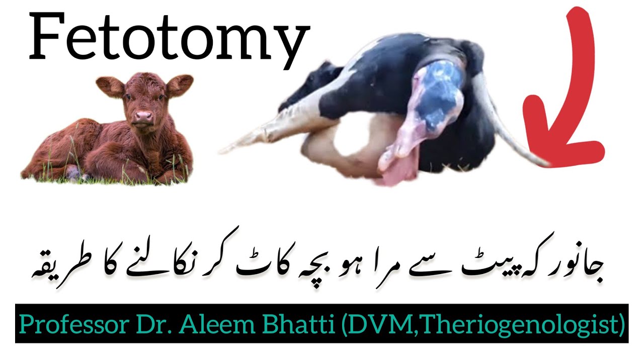 Fetotomy || how to remove dead fetus? مردہ بچا کاٹ کر نکالنے کا طریقہ ...