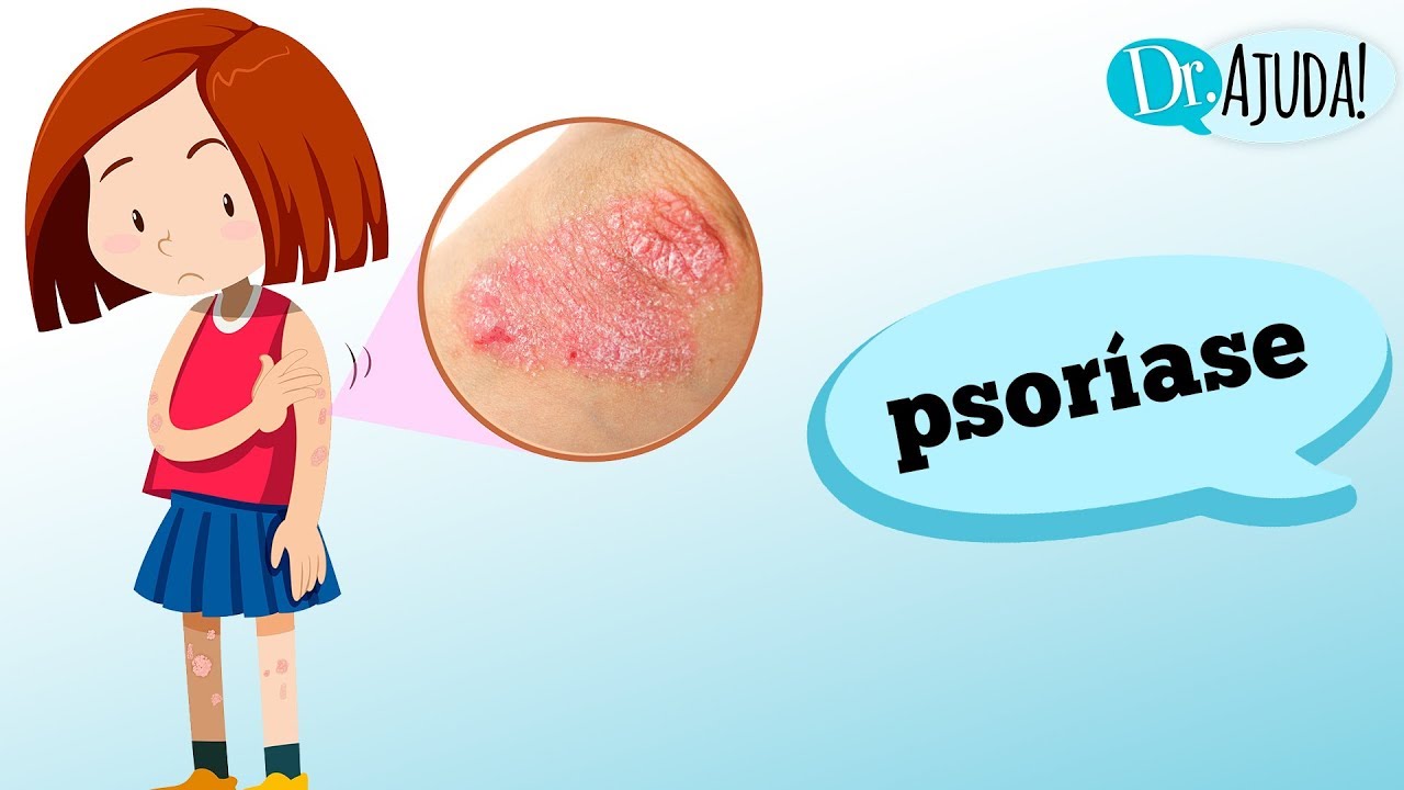 O que é PSORÍASE? Sintomas e características dessa doença inflamatória ...