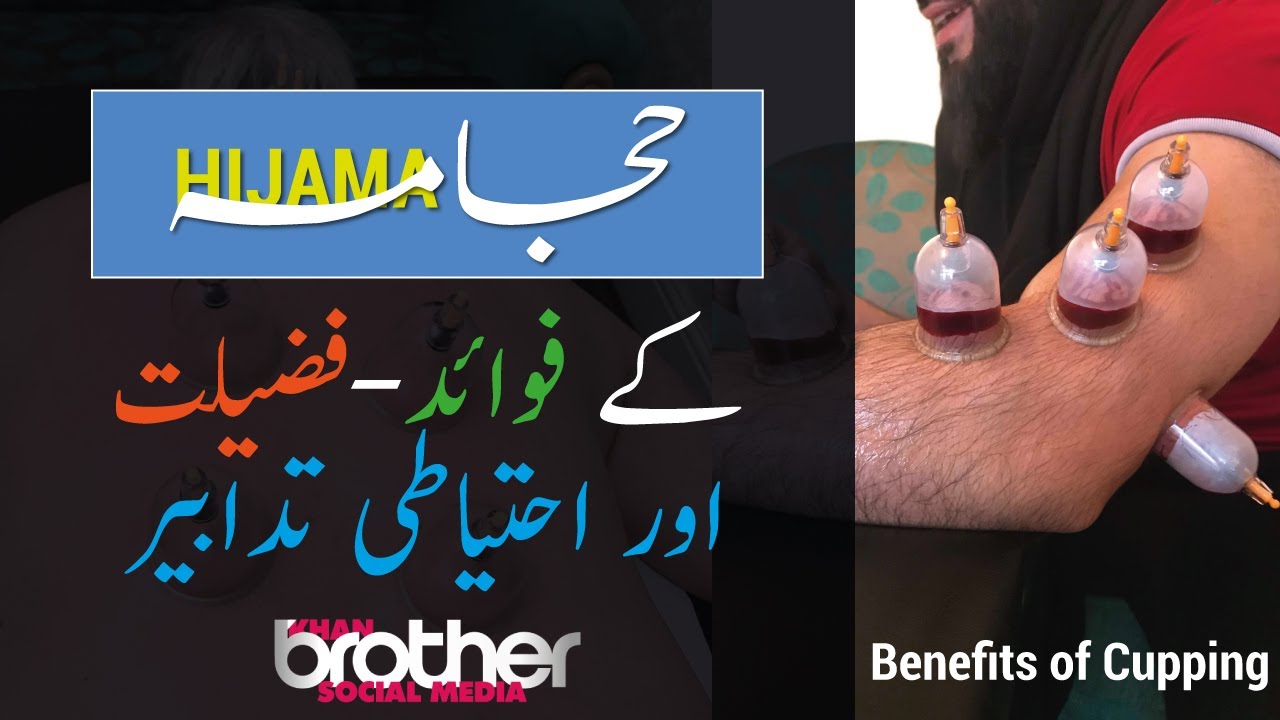 Benefits of Cupping|| Cupping Therapy|| Hijama|| حجامہ کے فوائد، فضیلت ...
