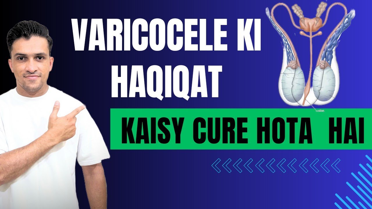 reality of varicocele natural treatment | big truth about varicocele ...