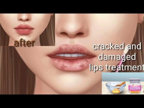 treatment of dry and damaged lips | relaxing and cooling #asmr - YouTube