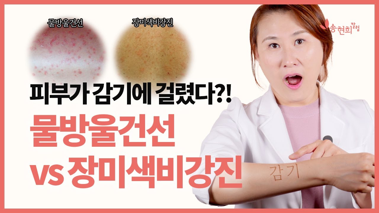 피부에 온 감기 물방울건선 Vs 장미색비강진 감별점과 치료관리법 Ft 인설 각질 Youtube