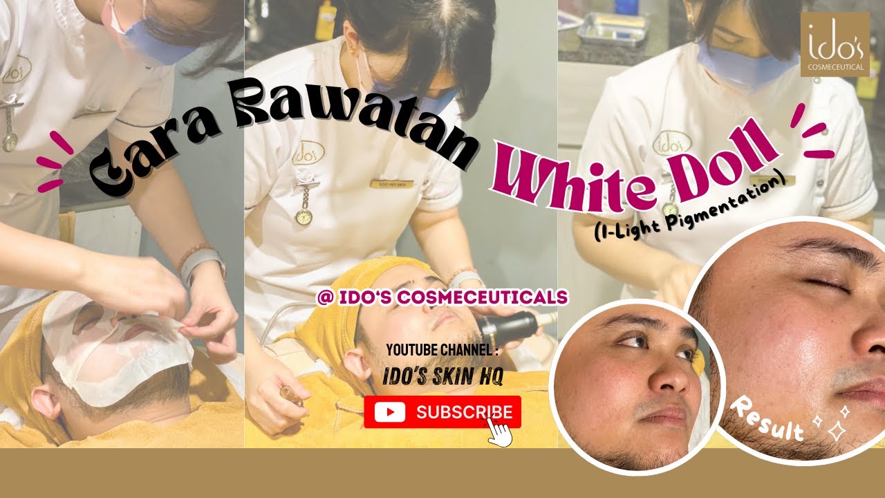 Cara Rawatan White Doll (I-Light Pigmentation) dilakukan di IDO'S Skin ...