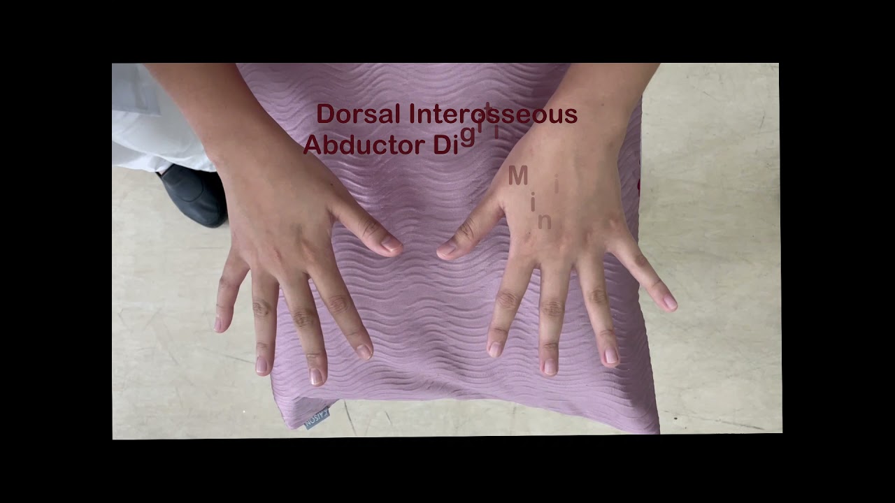Ulnar Nerve Examination (Group D) - YouTube