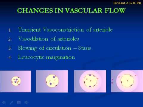 Inflammation: Introduction & Vascular and cellular events. - YouTube