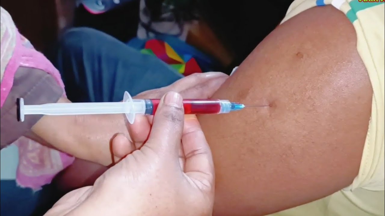 im intramuscular injection in the Arm.Vitamin b1,b6,b12 "Nugesic ...