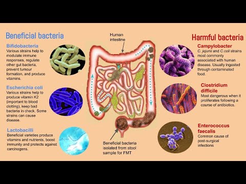 What is a Fecal Matter Transplant and how does it Effect Digestion and ...