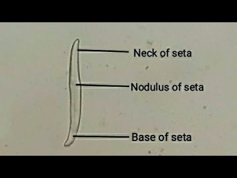 Temporary mounting & study of earthworm setae - YouTube