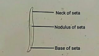 Earthworm Diagram Setae
