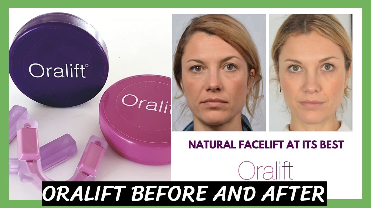 Oralift Before And After