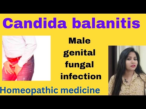 Candida balanitis treatment ! Male genital fungal infection symptoms ...