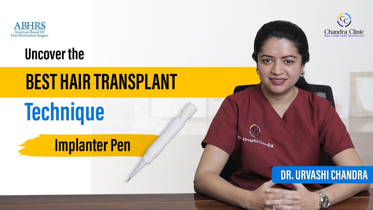 Implanter Pen Hair Transplant Technique: The Future of Hair Restoration ...