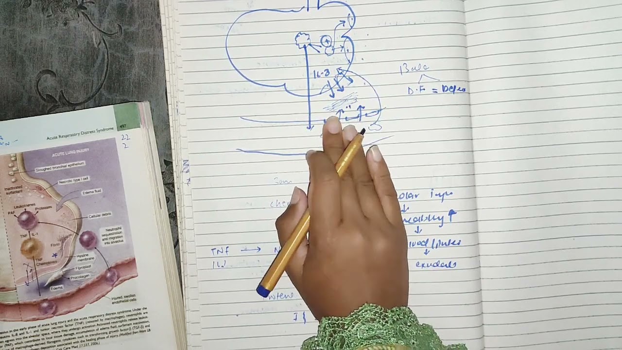 Acute Respiratory Distress Syndrome ARDS, #lungs_pathology #robbins # ...