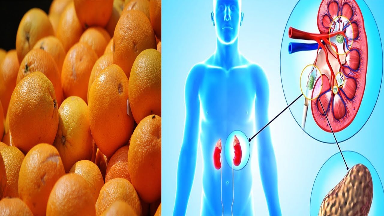 किन्नू फल के ये 10 फायदे दिमाग हिलाकर रख देंगे/kinu khane ke fayde ...