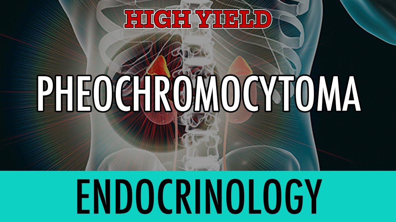 Pheochromocytoma - Pathology, Symptoms, Risk factors, Investigations ...