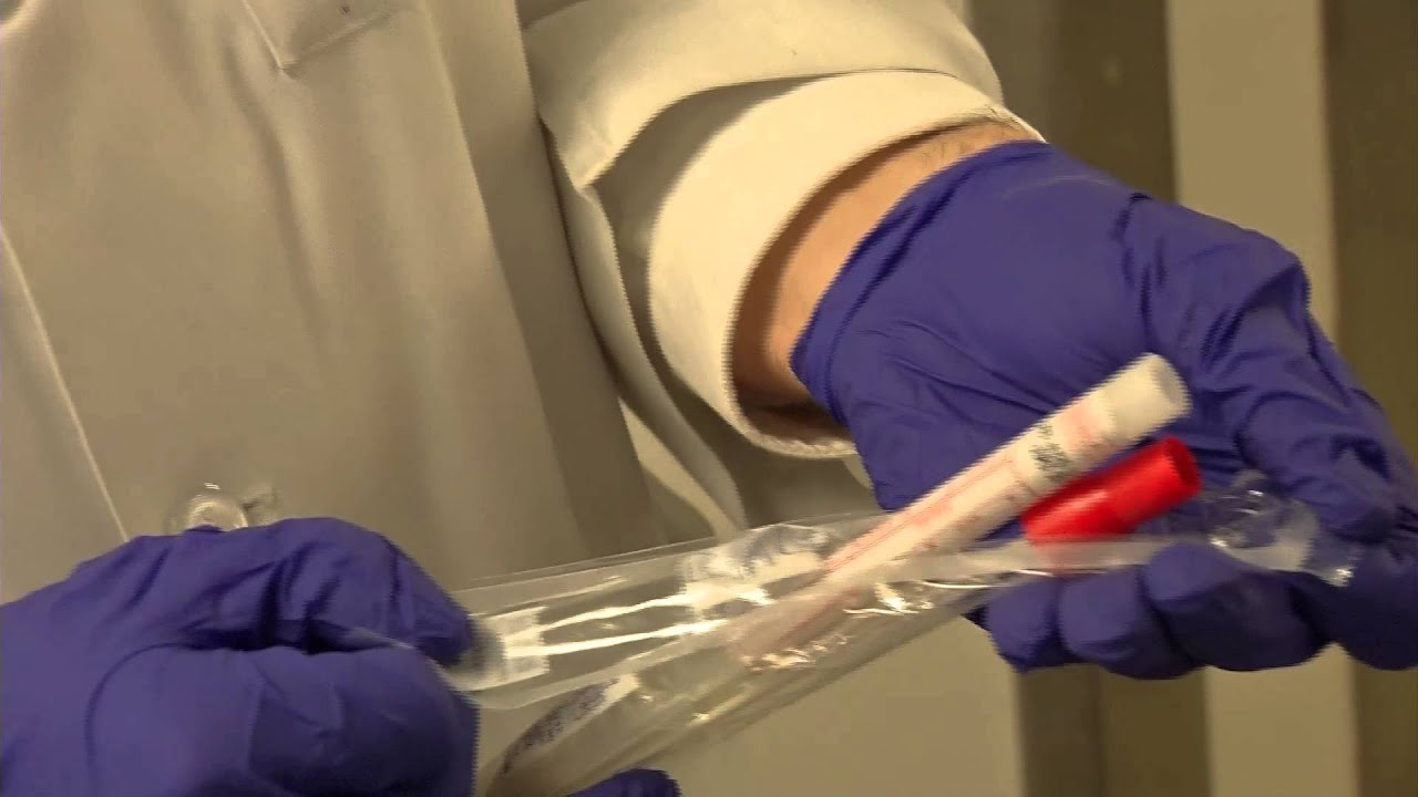 DEADLY INFECTIONS FROM PROSTATE BIOPSIES - YouTube