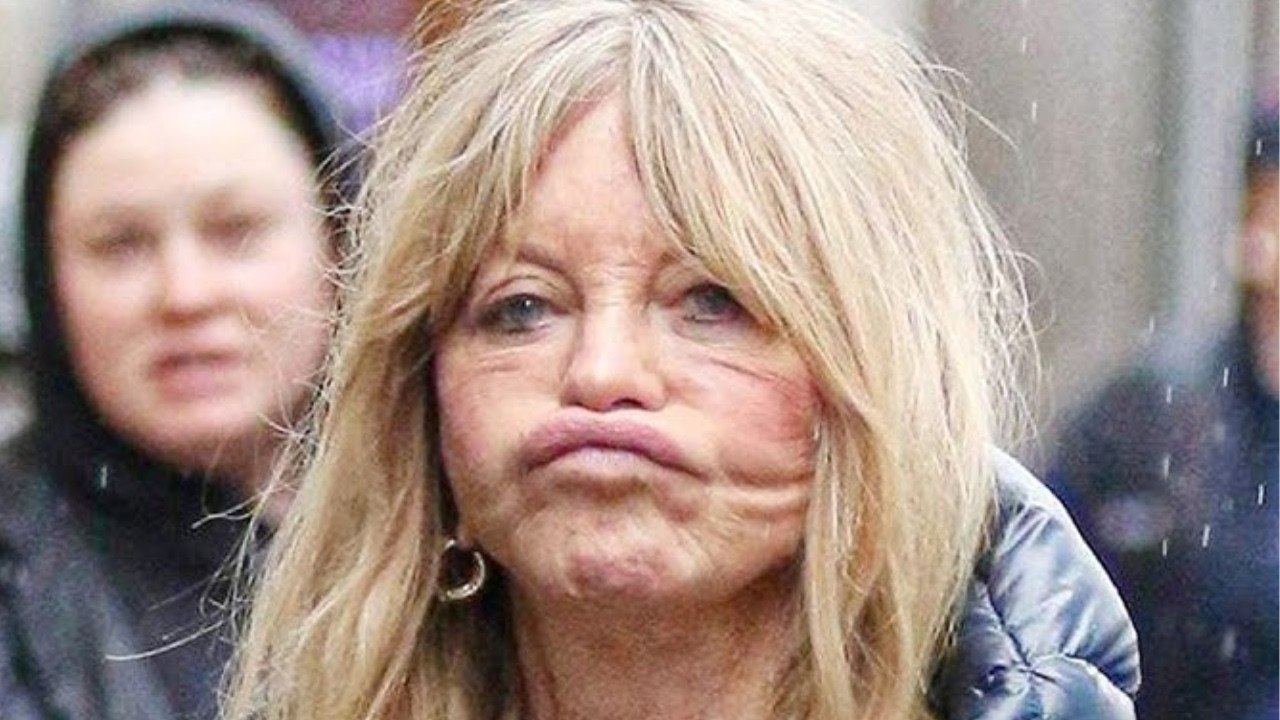 Celebrities That Got Insanely Botched After Plastic Surgery - YouTube