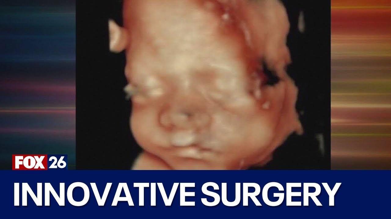Surgery at Texas Children's Hospital brings hope to unborn baby with ...