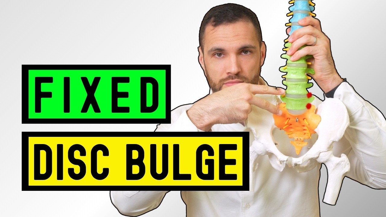 IDD Therapy To Fix Your Lumbar Disc Bulge Without Surgery - YouTube