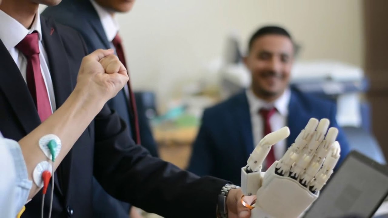 Prosthetic hand Prototype - YouTube
