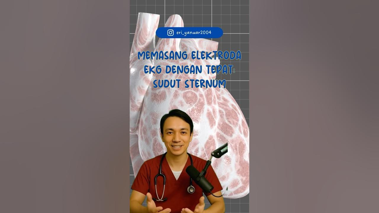 Sudut sternum #icunurse #nurseeriyanuar #perawaticu #perawatindonesia #perawatigd #iccu - YouTube