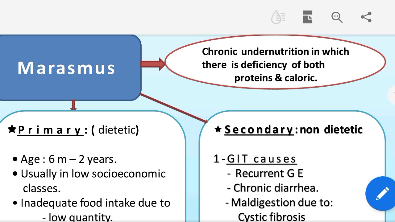 Nutritional disorders *part 2*.. pediatrics..2nd grade - YouTube