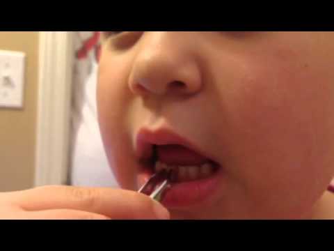 Wiggling that first loose tooth! - YouTube