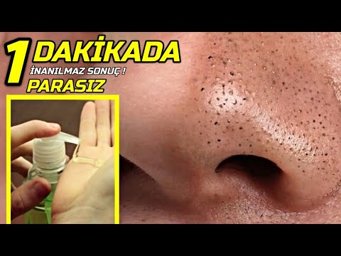 Evinizdeki Sıvı Sabuna Bunları Koyun 1 DAKİKADA SİYAH NOKTALARINIZDAN KURTULUN ! │ Güzellik Bakım