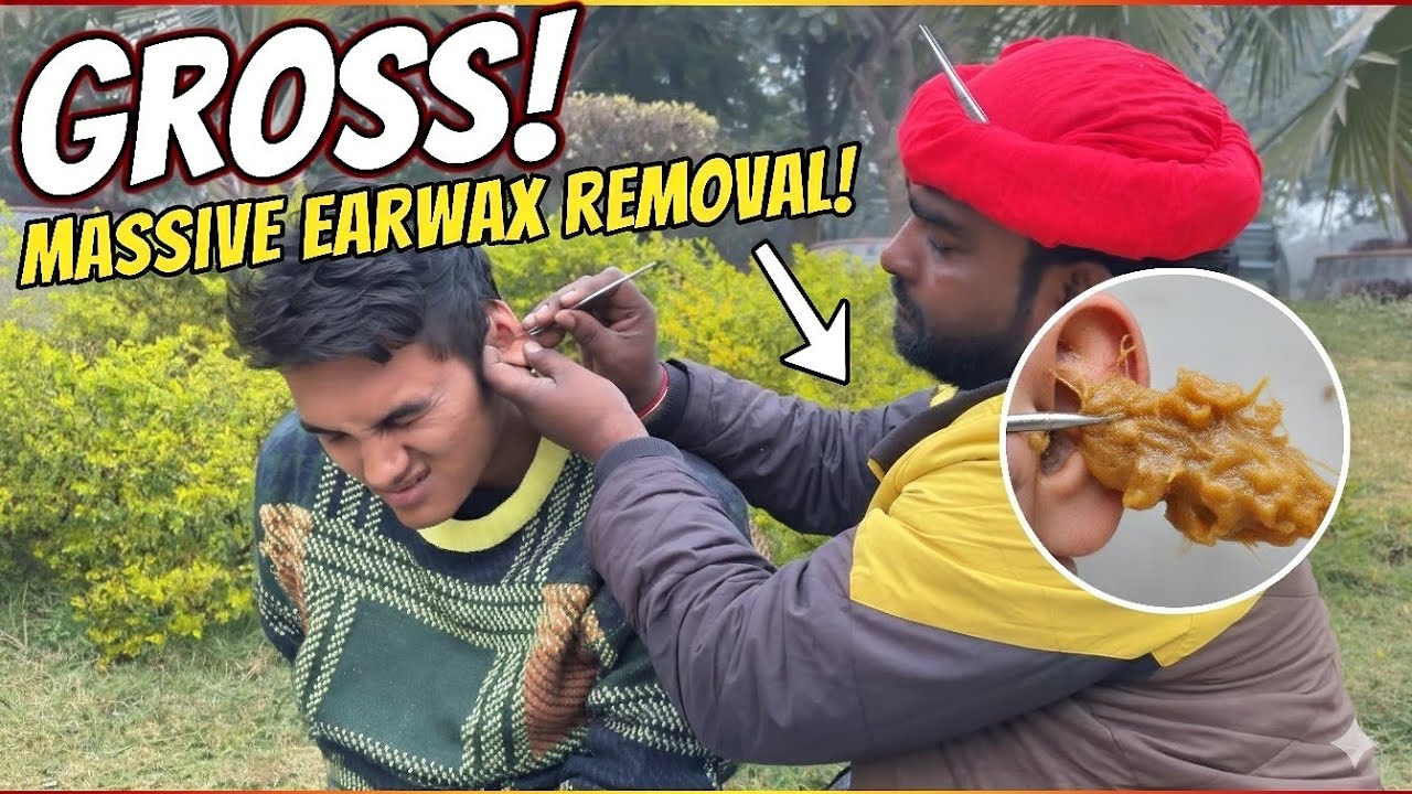 ASMR Earwax Removal: From Clogged to Crystal Clear | Total Ear Canal ...