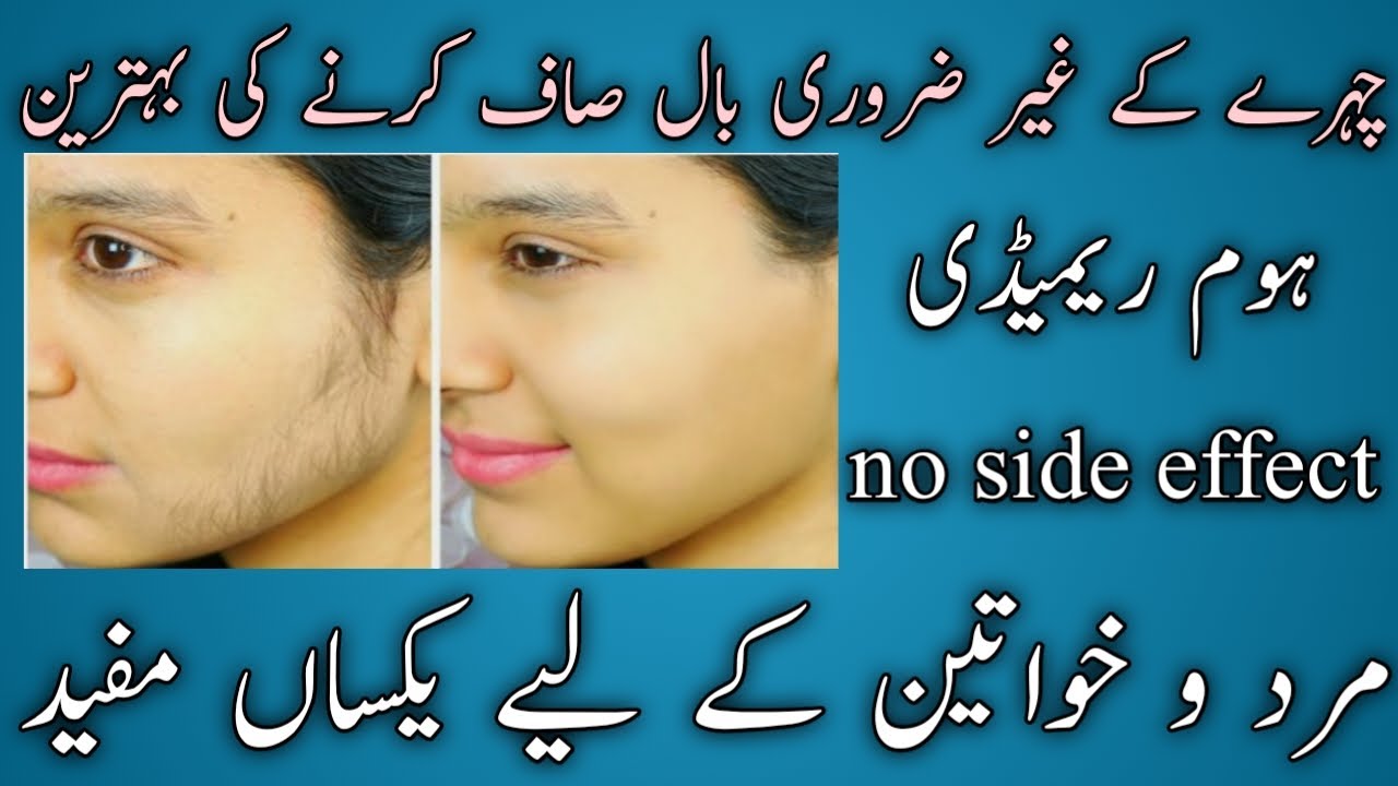unwanted Hair in unwanted-hair-in