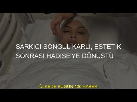 Şarkıcı Songül Karlı, estetik sonrası Hadise'ye dönüştü
