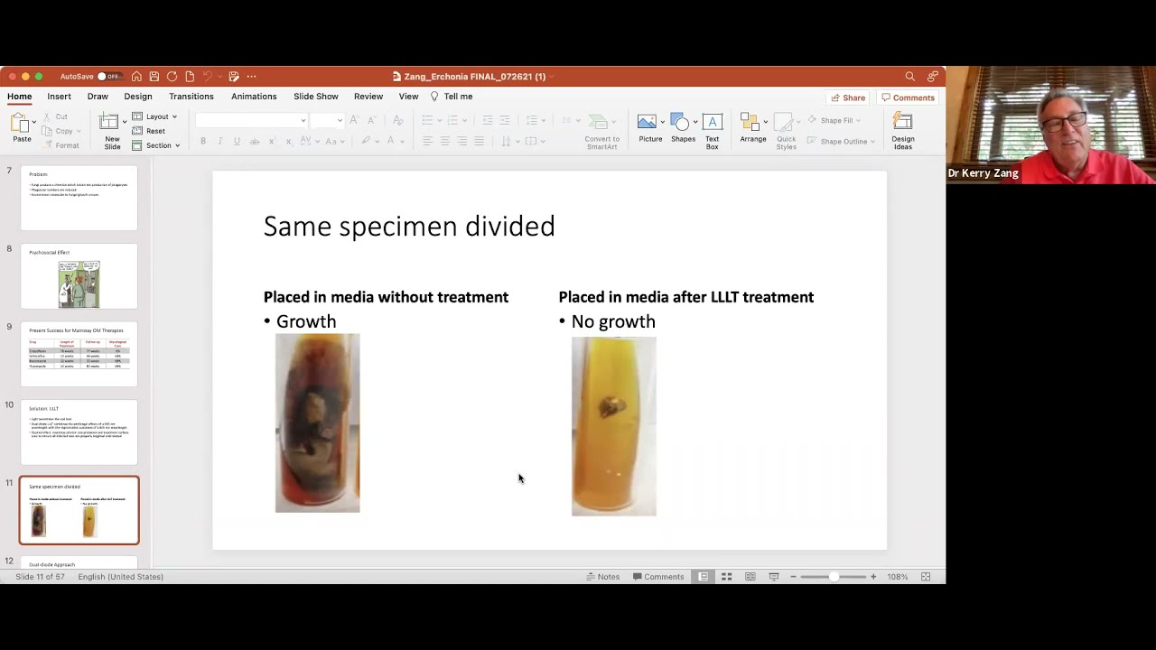 Onychomycosis Treatment with Non-Thermal Lasers Presented by: Kerry ...