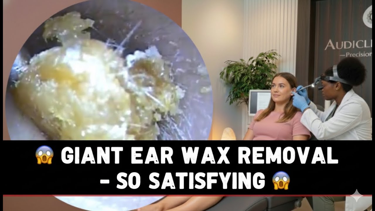 Heavy Ear Wax Removal | Super Satisfying ASMR - YouTube