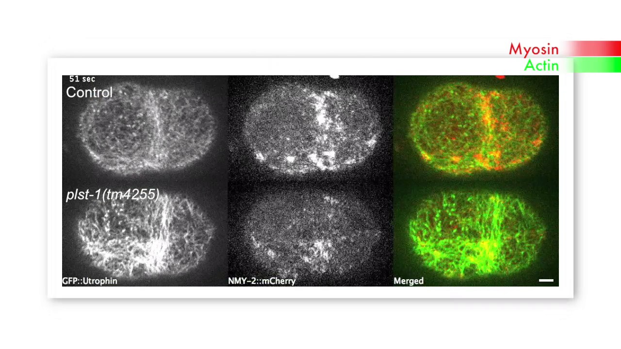 biosights: May 1 2017 - The cell cortex makes use of plastin’s ...